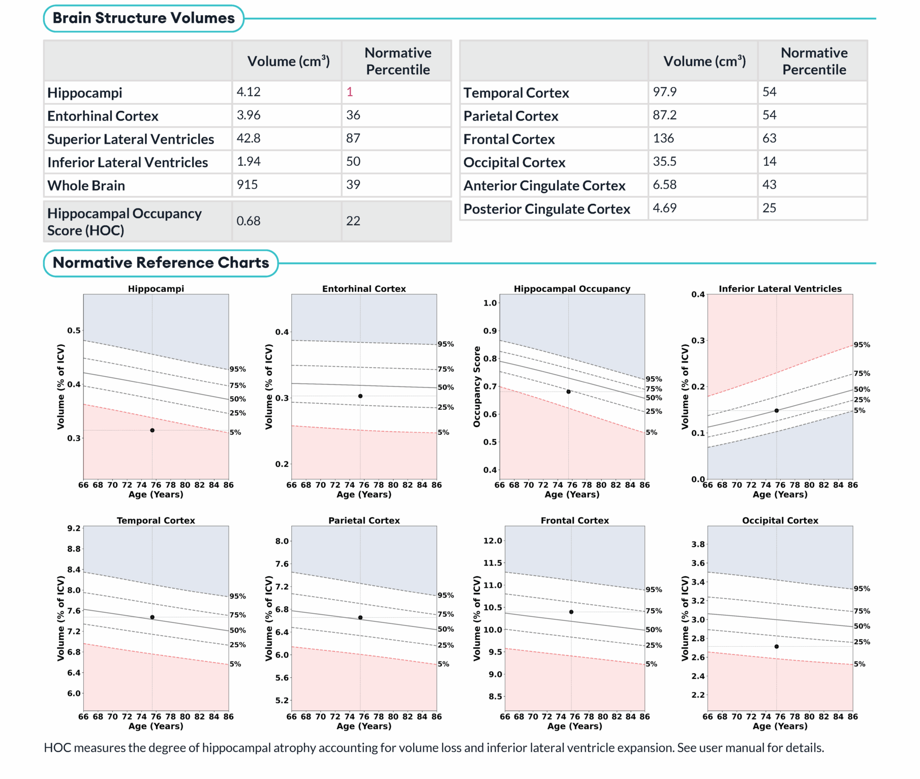 Understanding the Hippocampal Occupancy Score - Cortechs.ai
