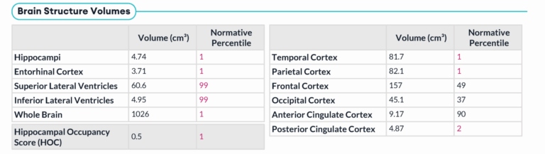 Understanding the Hippocampal Occupancy Score - Cortechs.ai