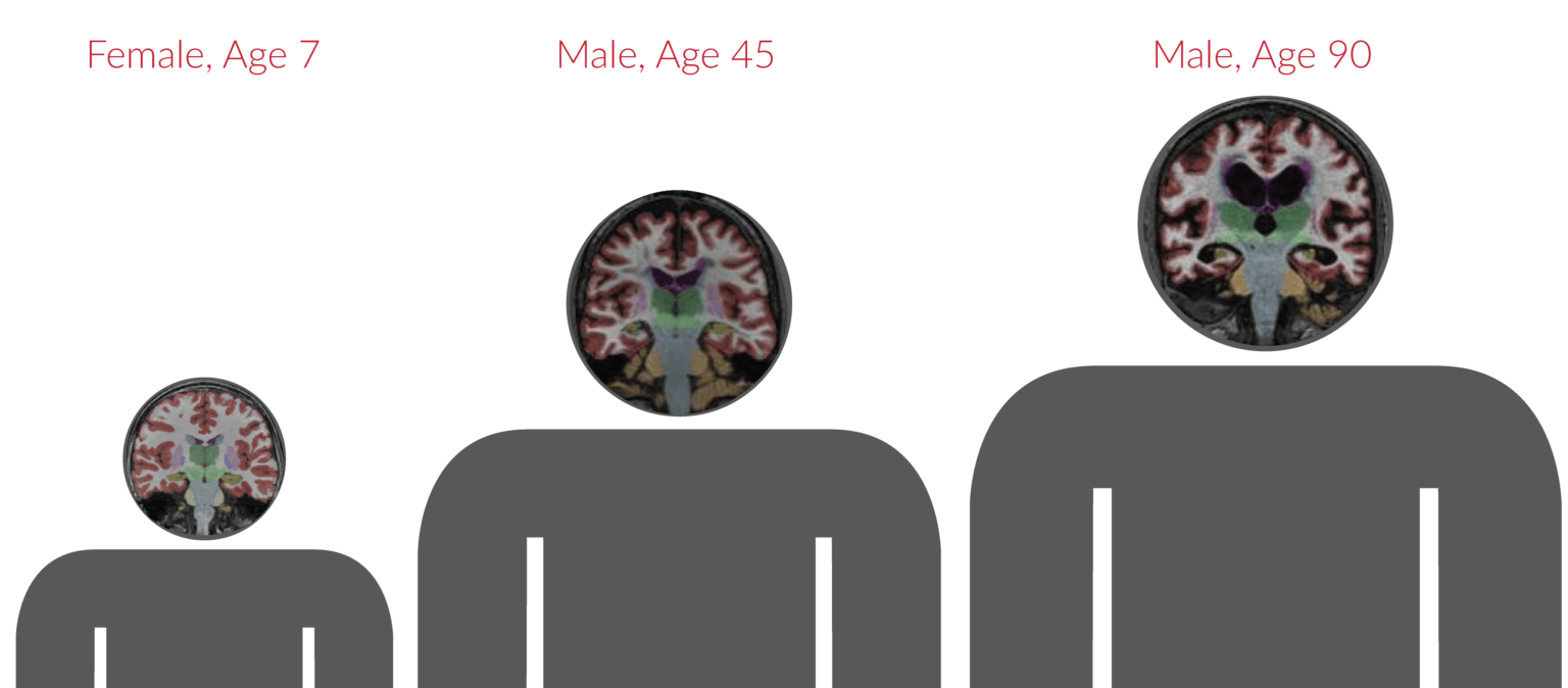 NeuroQuant 4.0's Dynamic Atlas: The Key to Optimal Brain Quantification ...