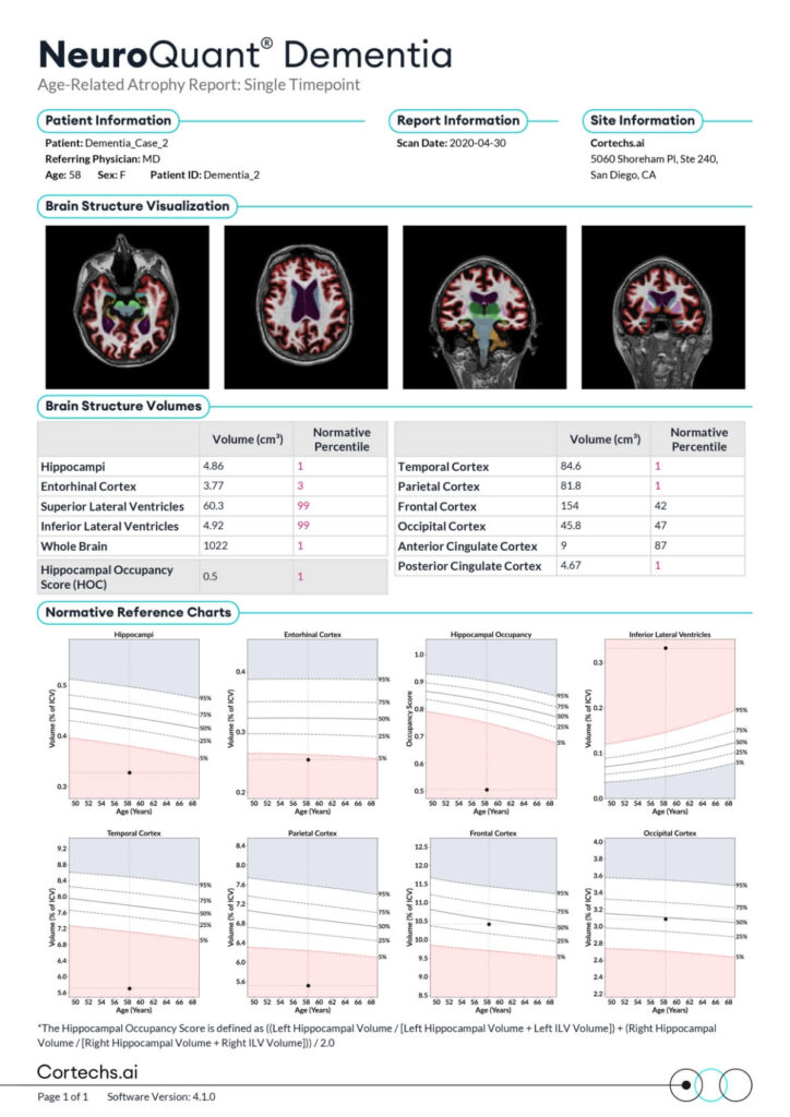 NeuroQuant - Cortechs.ai