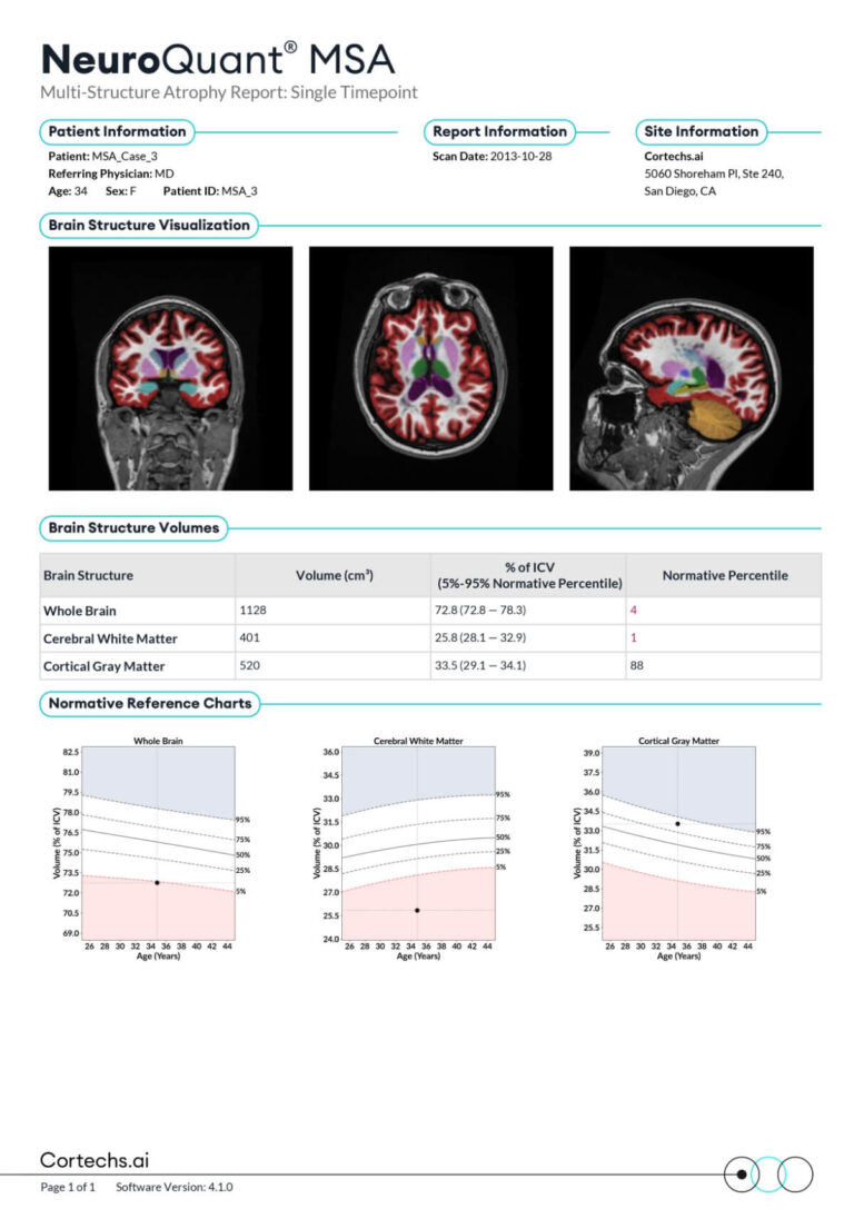 NeuroQuant - Cortechs.ai