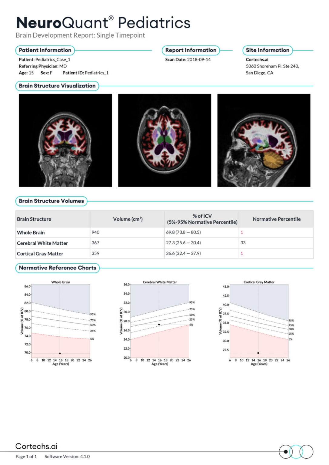 NeuroQuant - Cortechs.ai