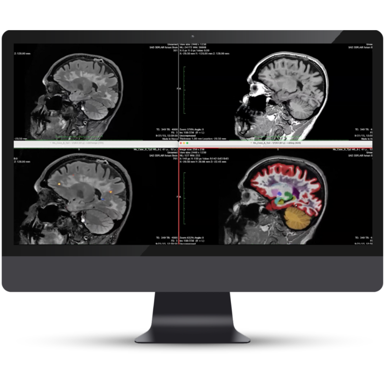 NeuroQuant - Cortechs.ai