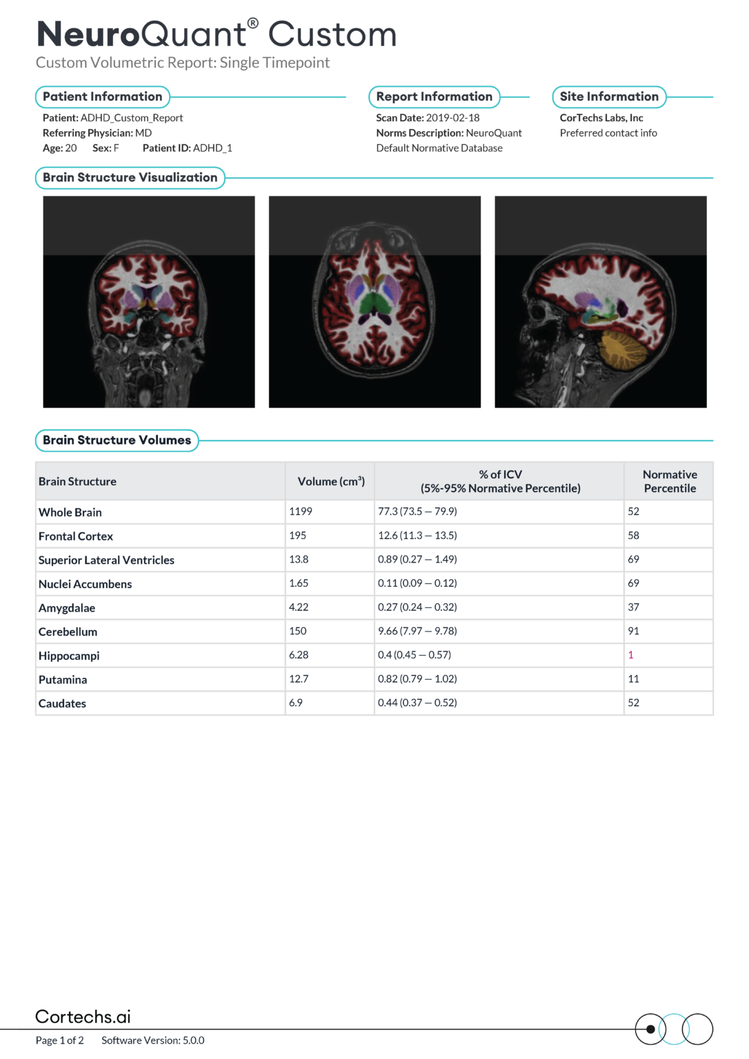 NeuroQuant - Cortechs.ai