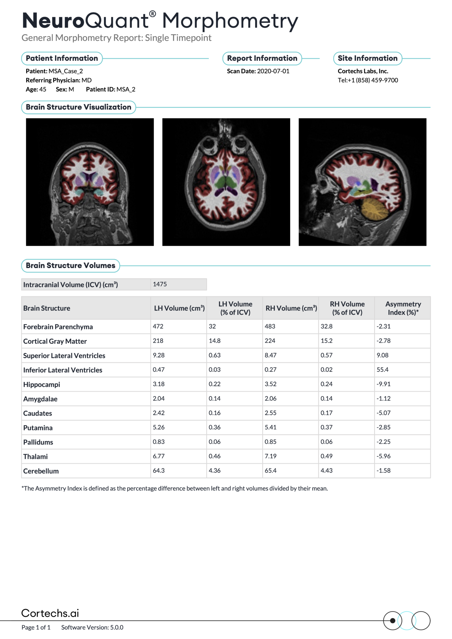 NeuroQuant New - Cortechs.ai