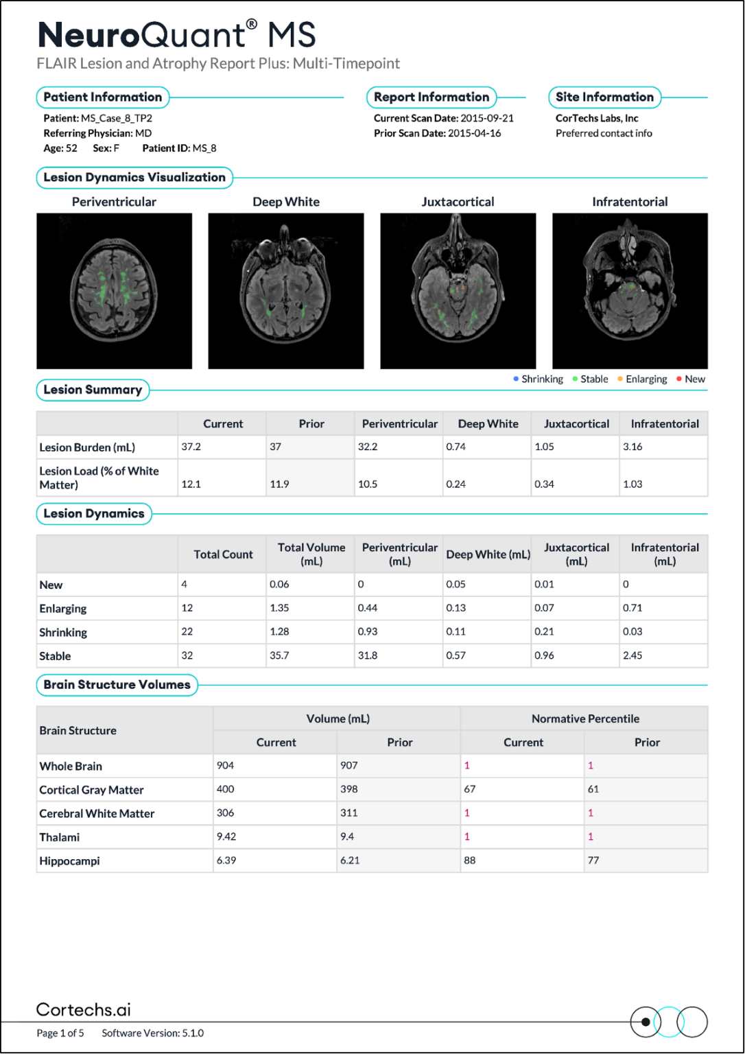 Introducing NeuroQuant MS Lesion Dynamics Computation: A Clearer Path ...