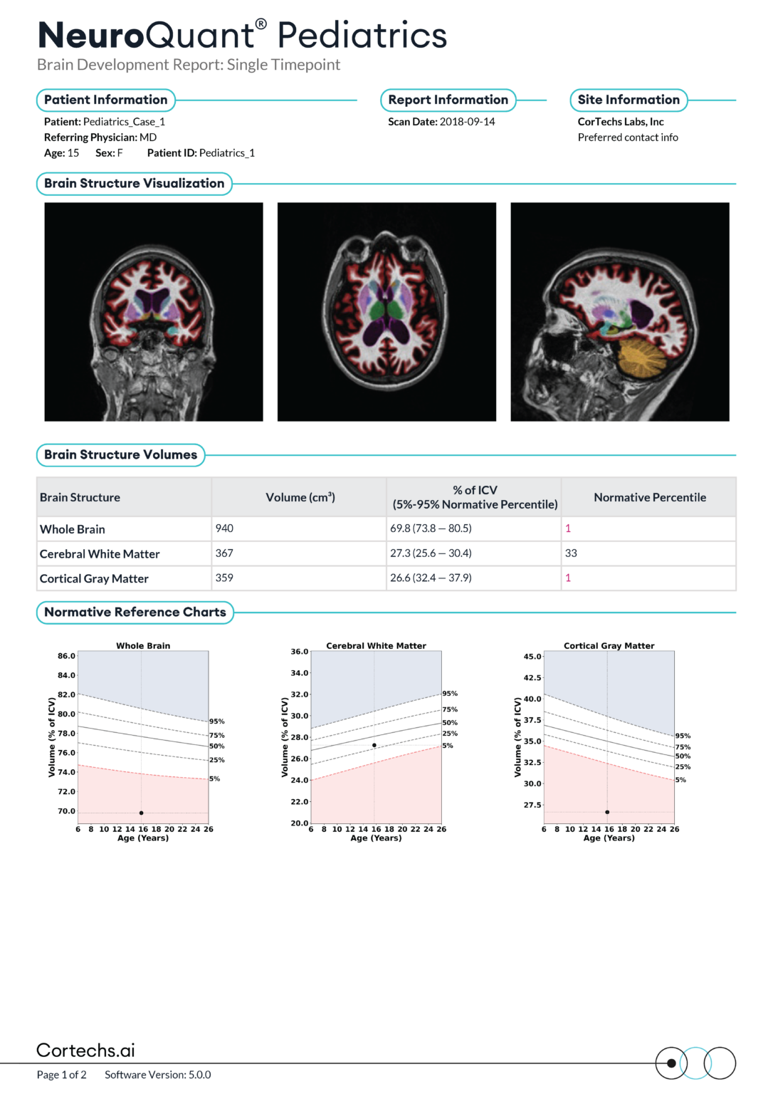 NeuroQuant - Cortechs.ai