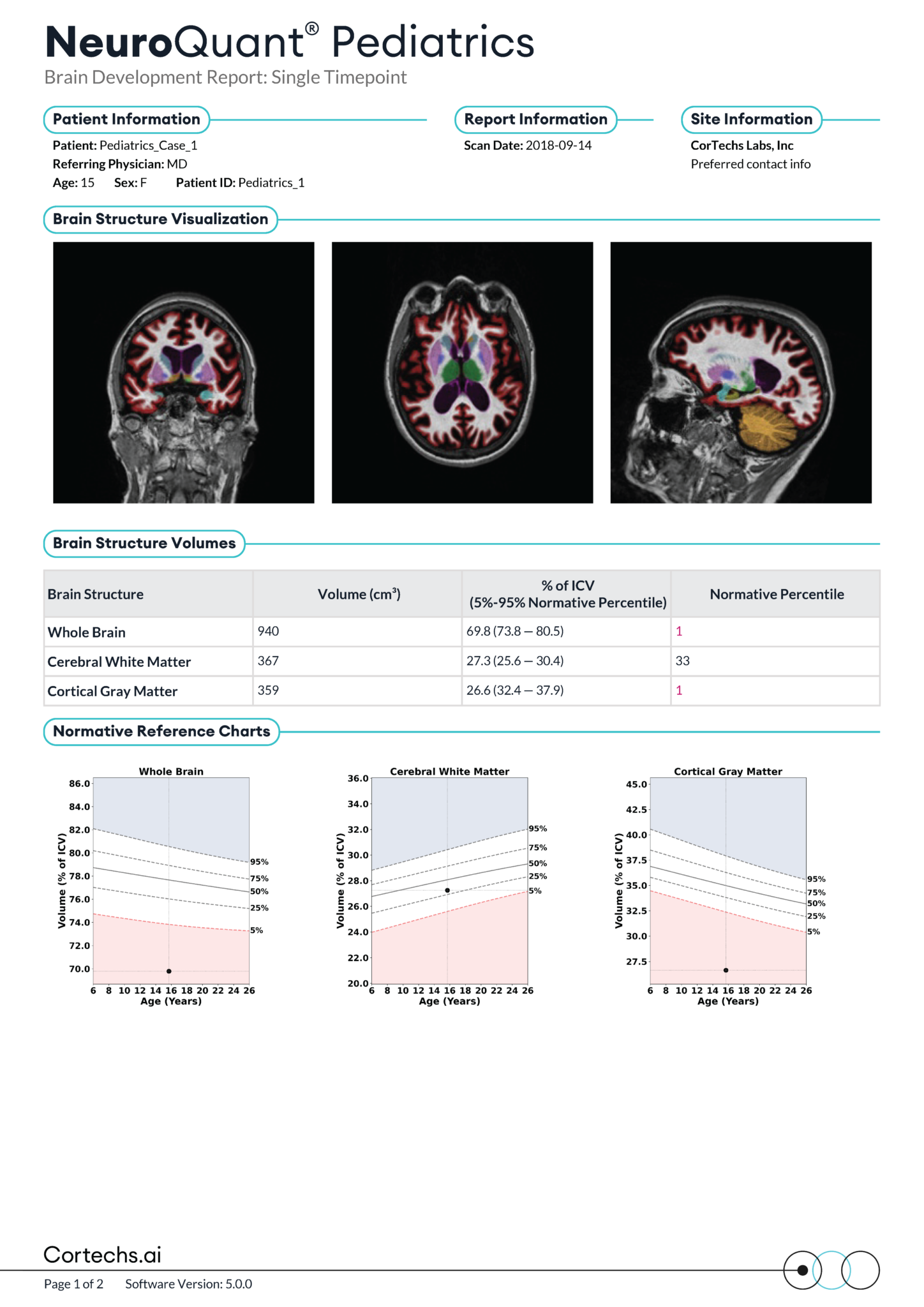 NeuroQuant New - Cortechs.ai
