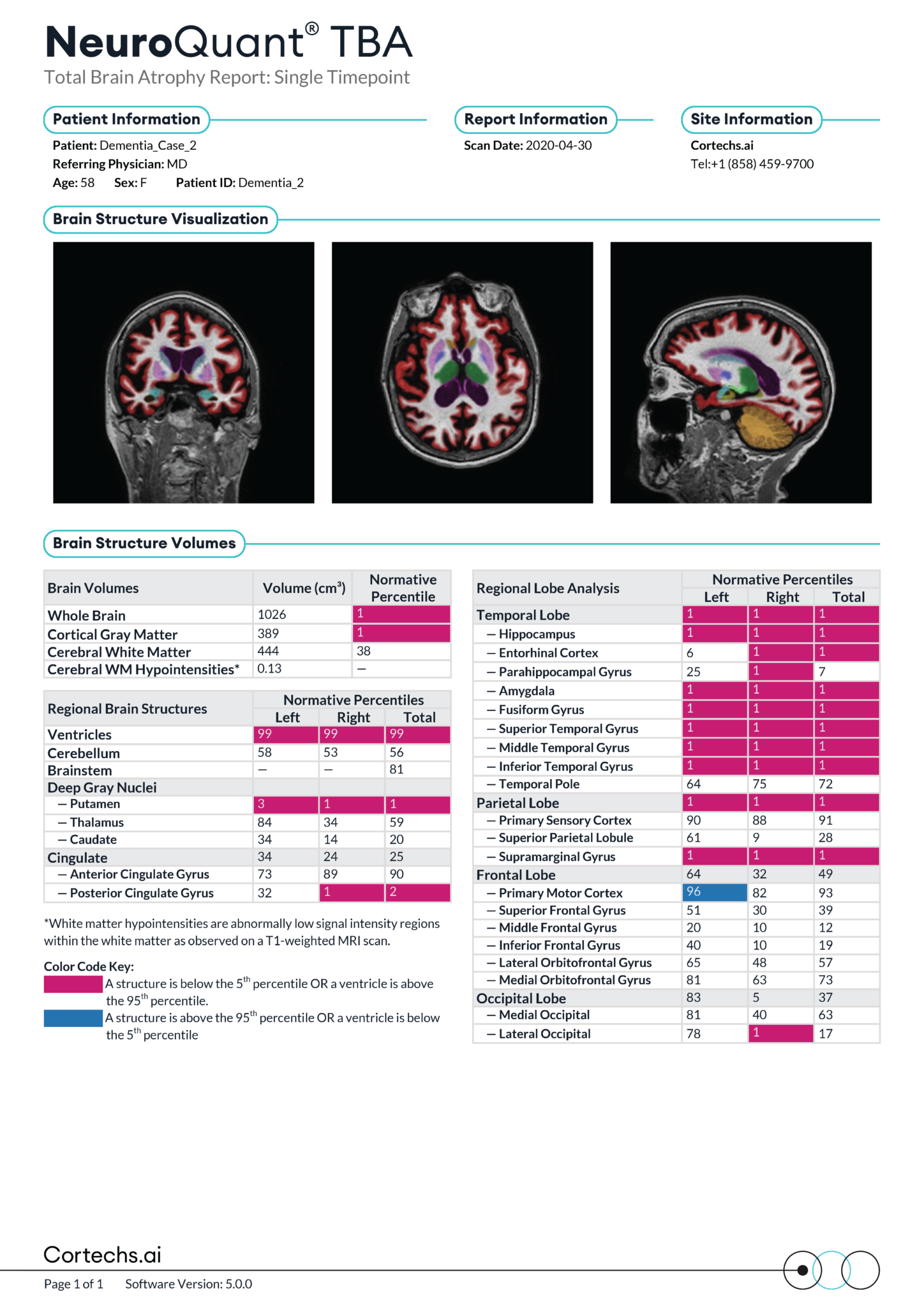 NeuroQuant New - Cortechs.ai